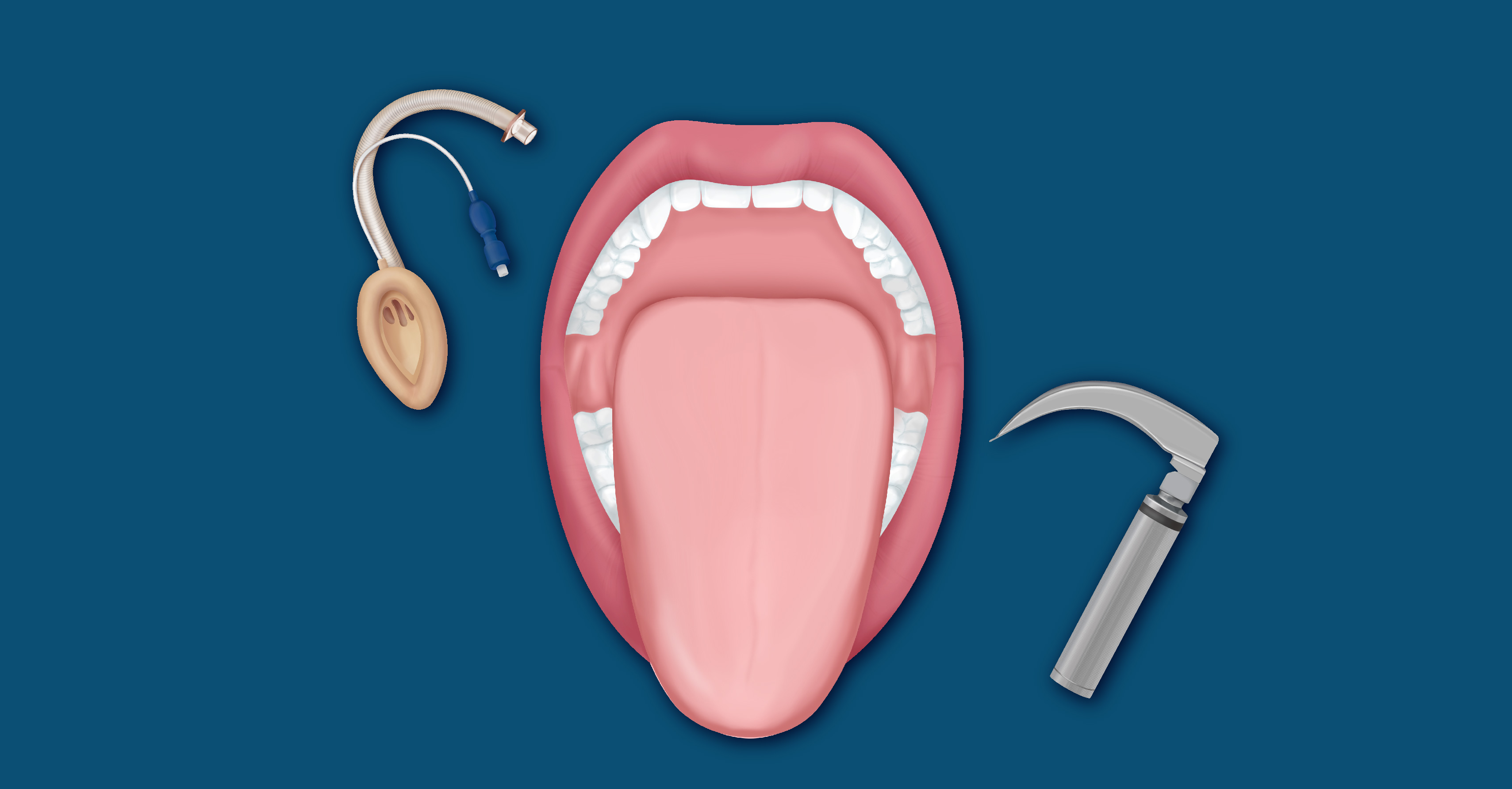 2022 ASA Difficult Airway Algorithm Guidelines: What's New?