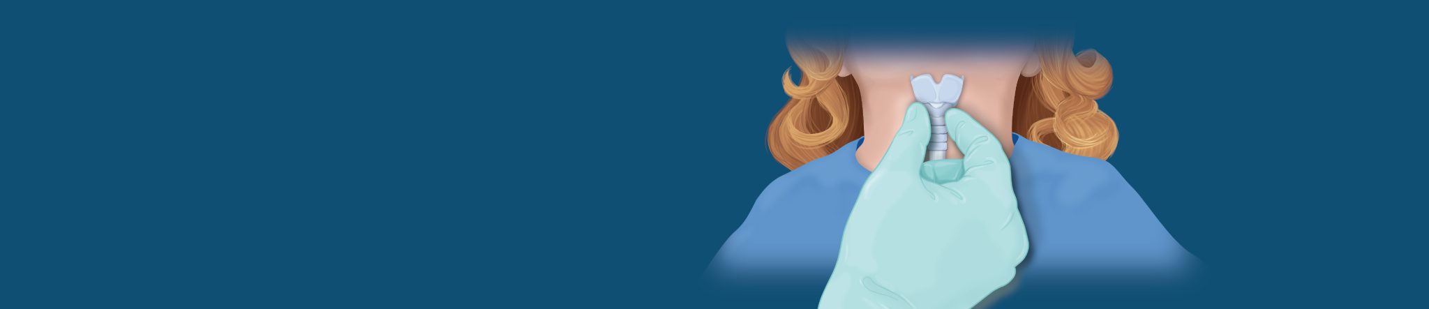 The Application of Cricoid Pressure in Pediatric Patients