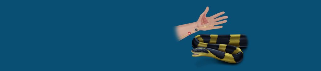 Using Train-of-Four Monitoring for Anesthesia Recovery