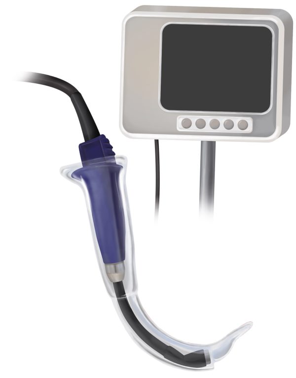 Direct vs Video Laryngoscopy: Anesthesia Technology Advances